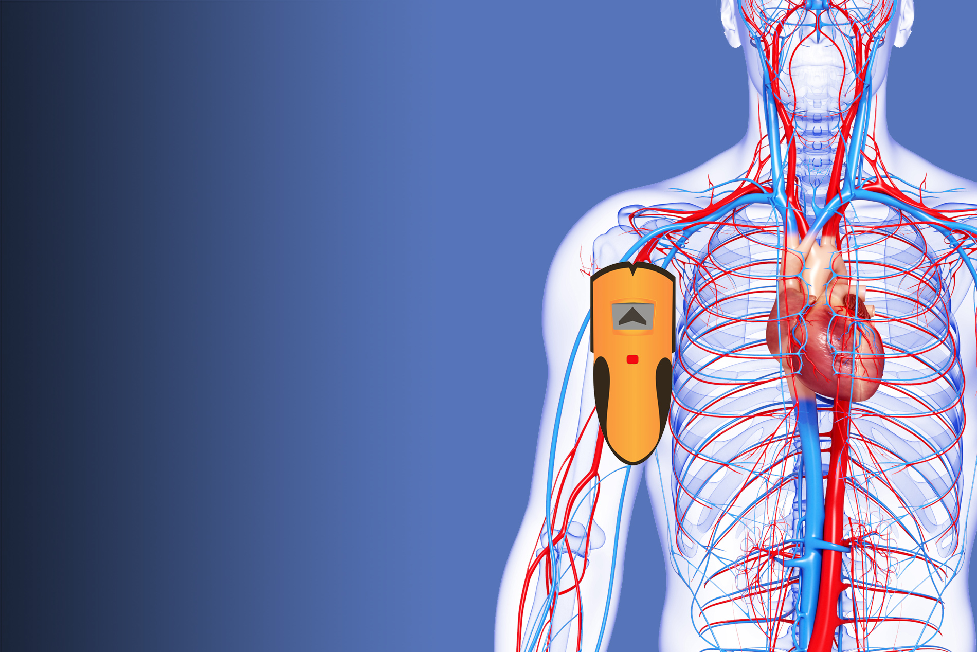 Accelerate-Home-Hero-Needless-Needles | UW Medicine