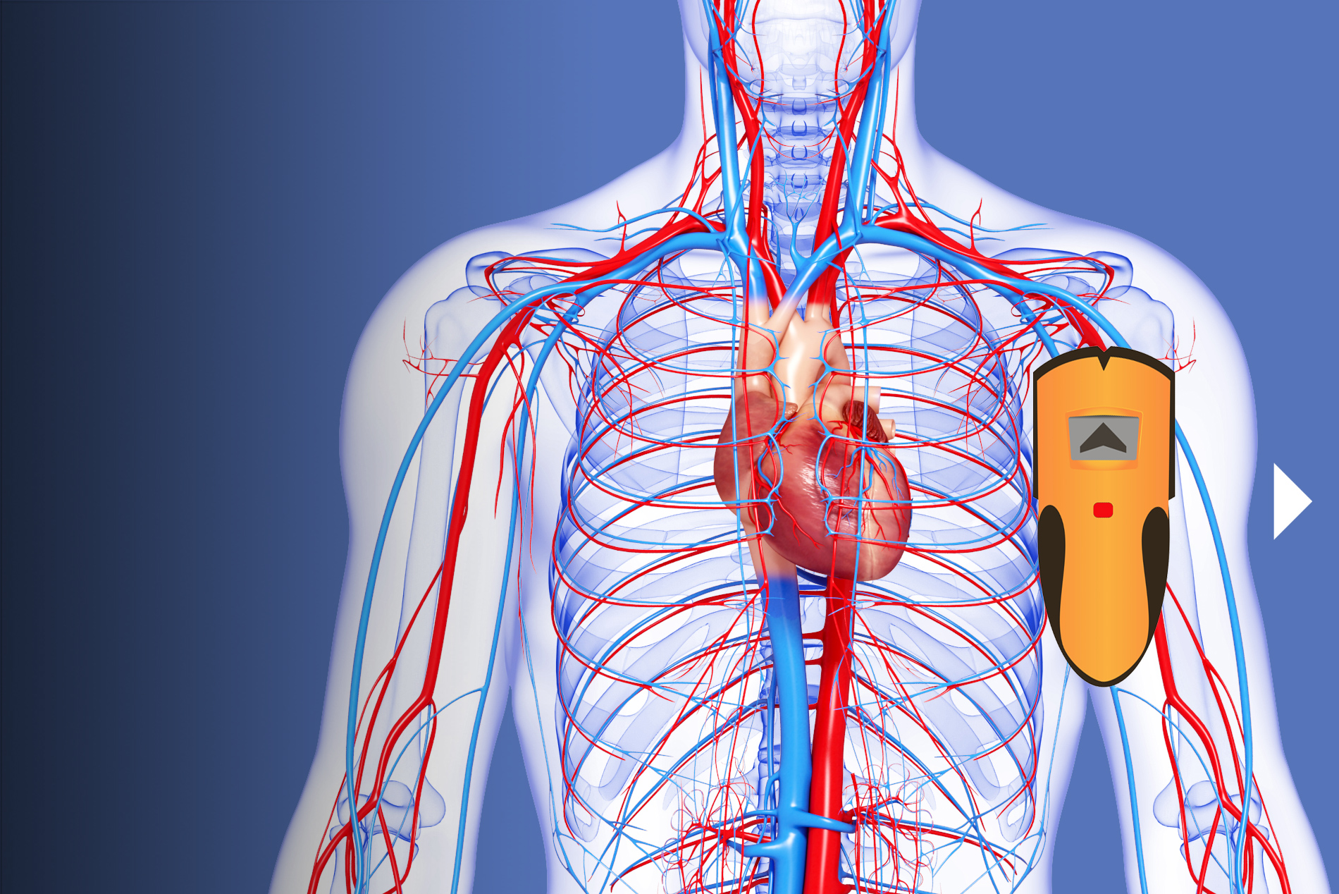 Story-Hero-Needless-Needles | UW Medicine