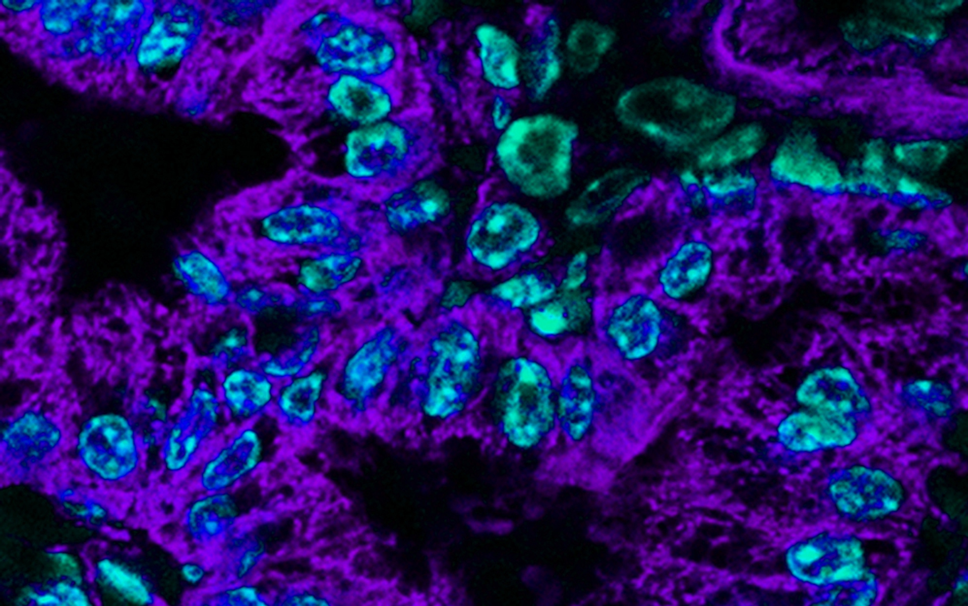 Nora-Disis-Podcast-Hero - UW Medicine: Shortening the Distance to ...